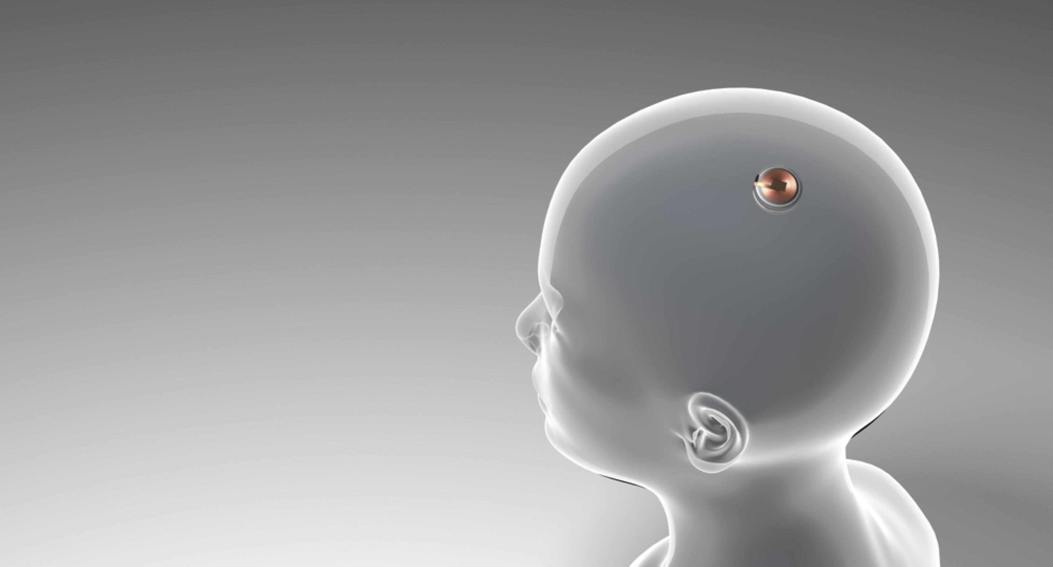 Neuralink lance les tests de puces sur les humains - Radio Nova